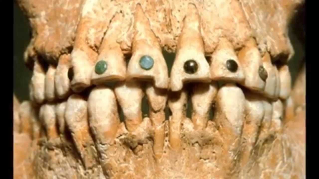 Crime and Punishment in Ancient Surgery