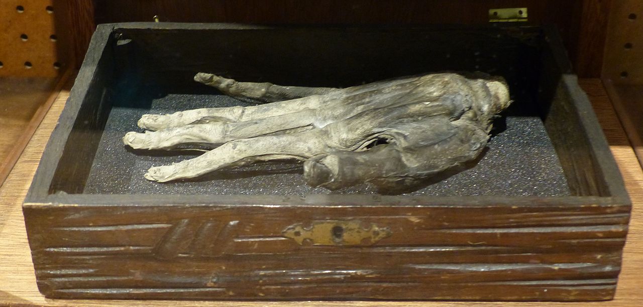 ‘Hand of Glory’: Gallows Tradition and Healing in Early Modern England ...