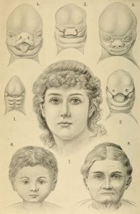 Honor and "Face": Living with Facial Disfigurement in Early Medieval ...