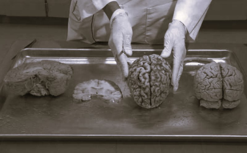 Journey to 'Sapiens': The Evolution of Human Intelligence