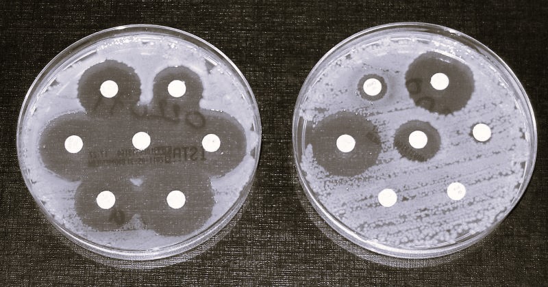 Alexander Fleming and the Discovery of Penicillin in 1928