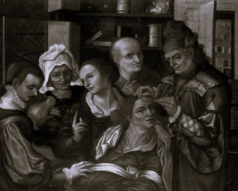 The 'Stone of Madness' and the Art of Brain Surgery in the Renaissance