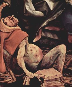 Burning Faith: Ergotism – The Scourge of “St. Anthony’s Fire” in the ...